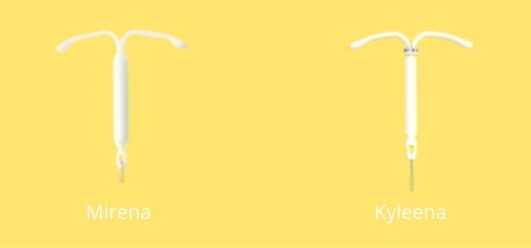 DIU Kyleena: veja as semelhanças e diferenças para o Mirena
