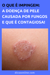 Impingem: saiba o que é e como tratar