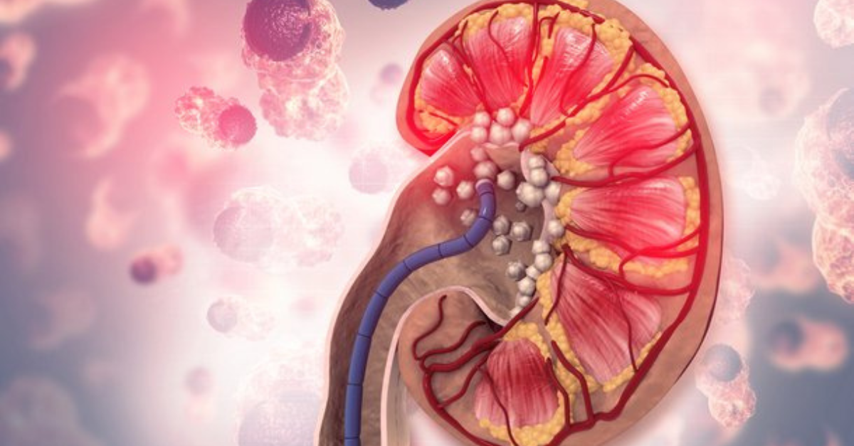 Aquecimento global e doenças renais: qual a relação?