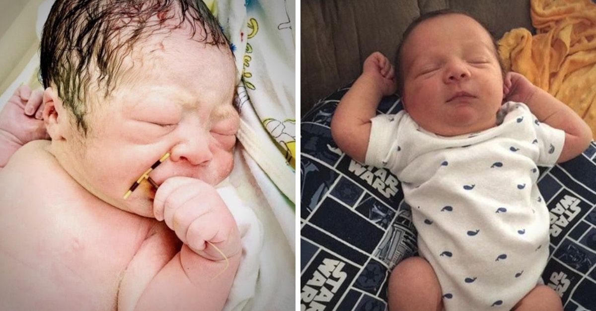Bebê nasce segurando o DIU e surpreende a equipe médica