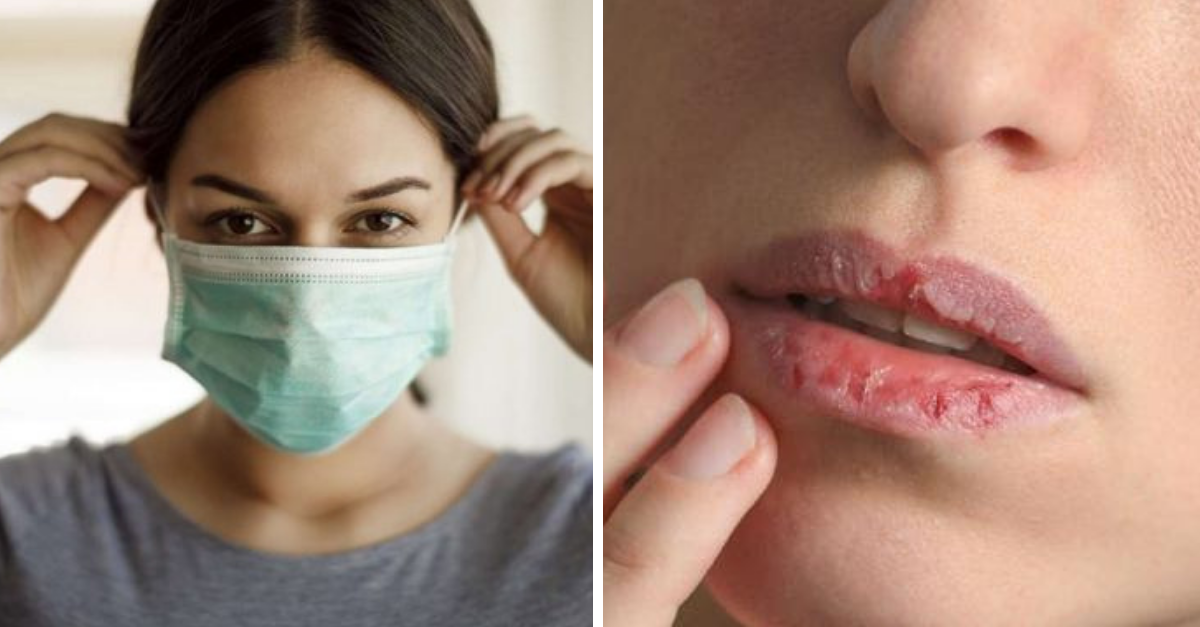 Máscaras de proteção x Lábios ressecados