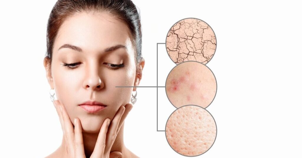 Espinha interna: como tirar e o que fazer para evitar