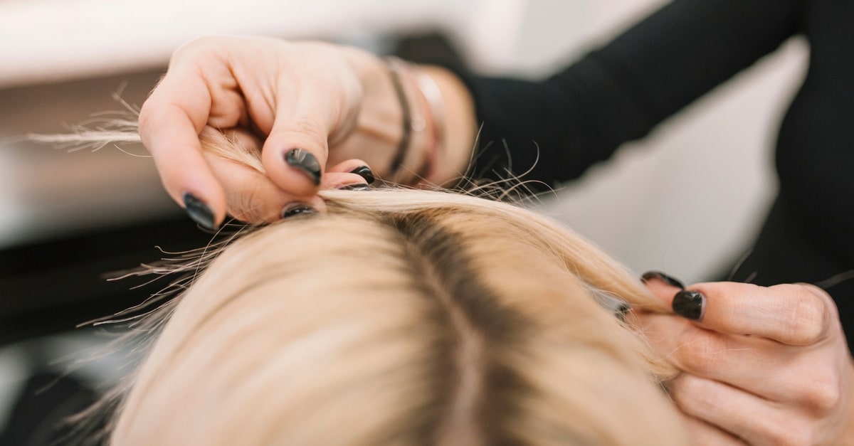 Caspa: o que é, causas e como eliminar