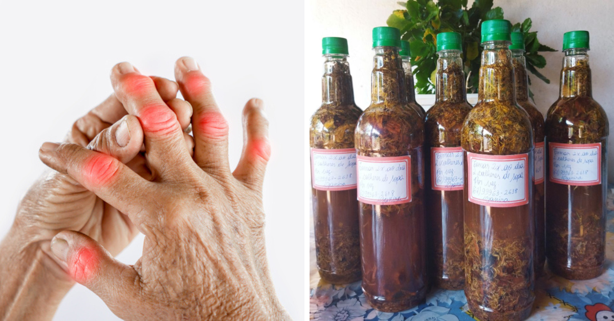 Como Fazer Garrafadas Medicinais Para Inflamação - NAZAEDU