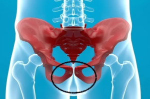 Pubalgia: o que é, sintomas e tratamento