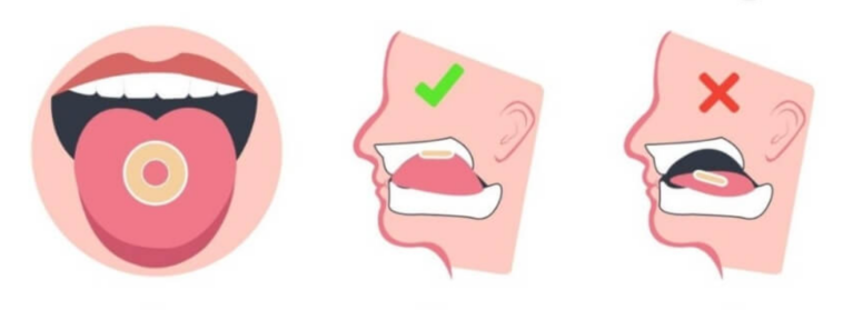 O que é mewing? Como definir o maxilar com esta técnica?