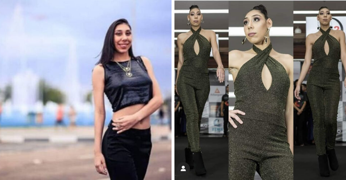 Ana Victória é a primeira modelo com microcefalia no mundo