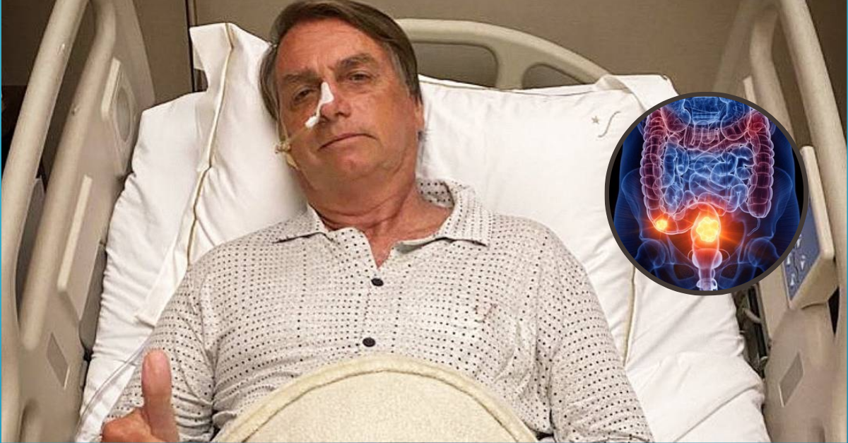 Obstrução intestinal: possíveis causas e principais sintomas