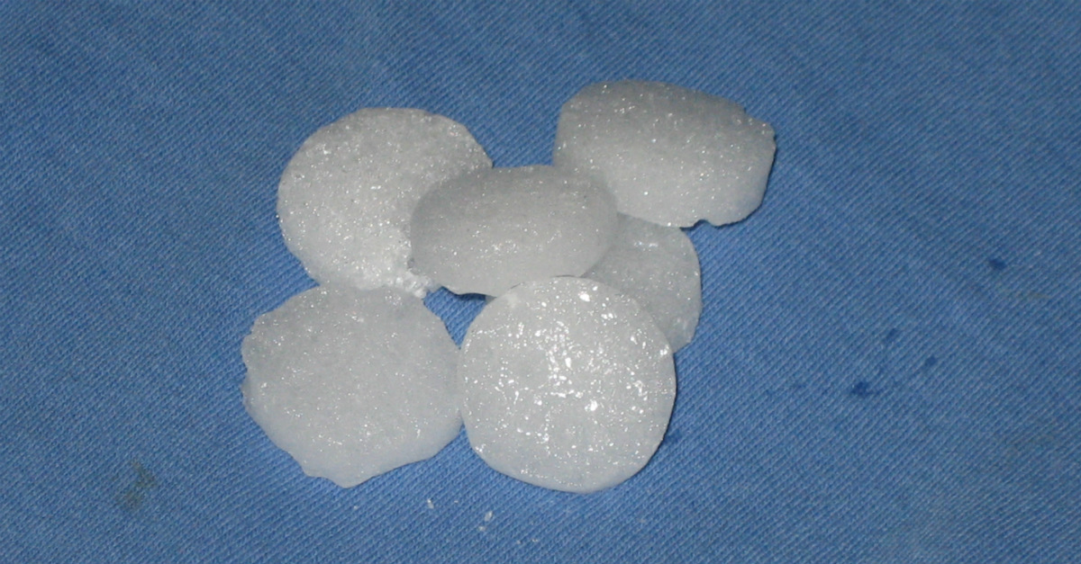 Naftalina: para que serve e como utilizar da forma correta?