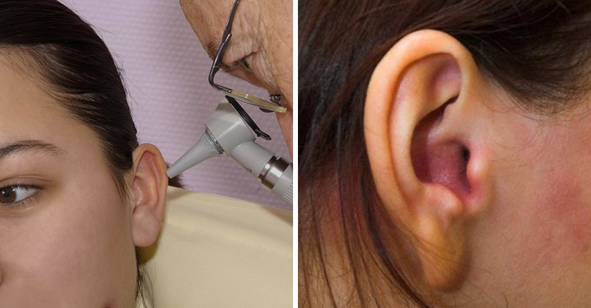 Otite: tire todas as suas dúvidas sobre essa inflamação no ouvido