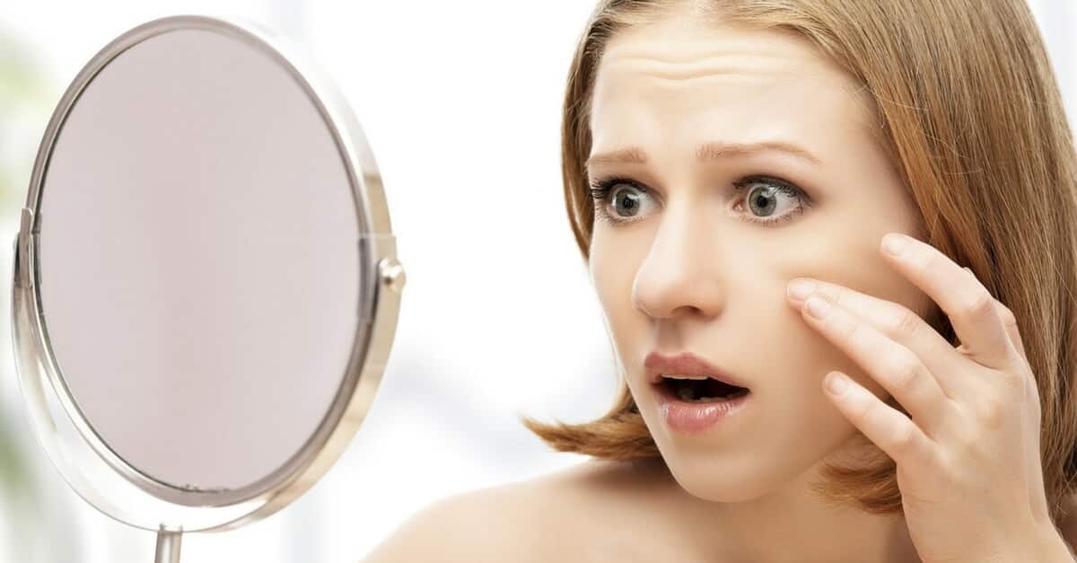 Aprenda A Preparar A Máscara Que Age Contra Acne Rugas E Cicatrizes