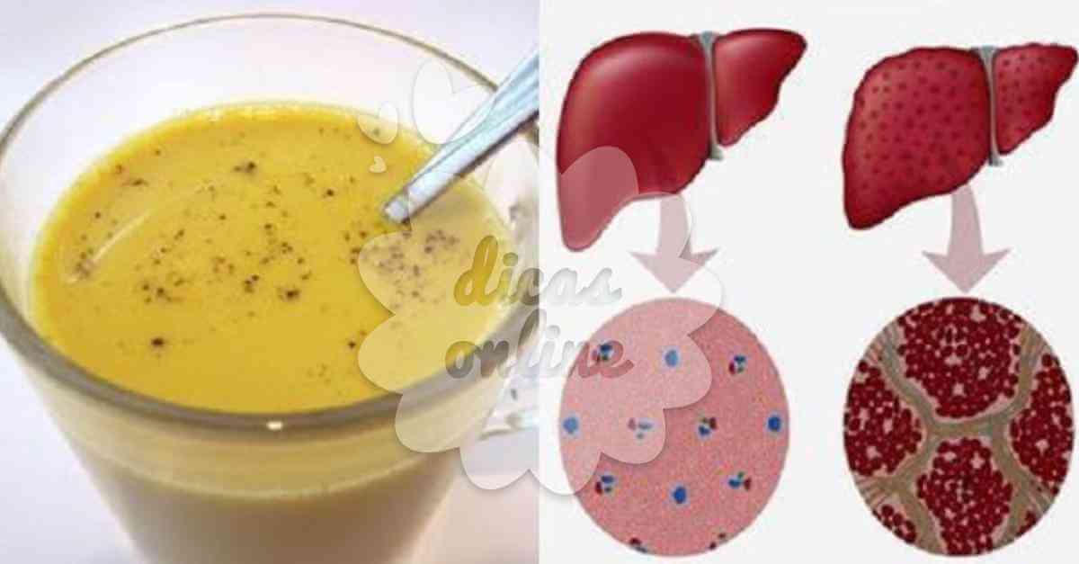 10 Remédios para desintoxicar o fígado: naturais e fármacos