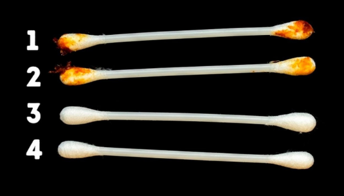 O que esconde a cor da cera dos ouvidos?