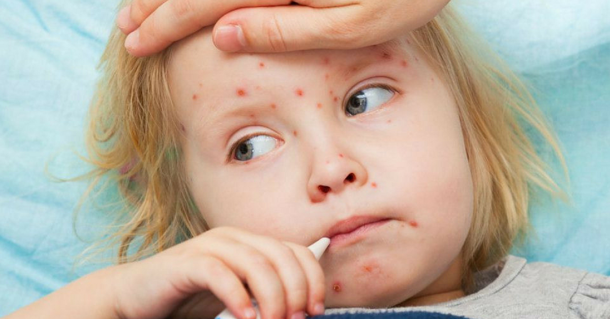 Conheça os sintomas, tratamento e prevenção do sarampo em bebê