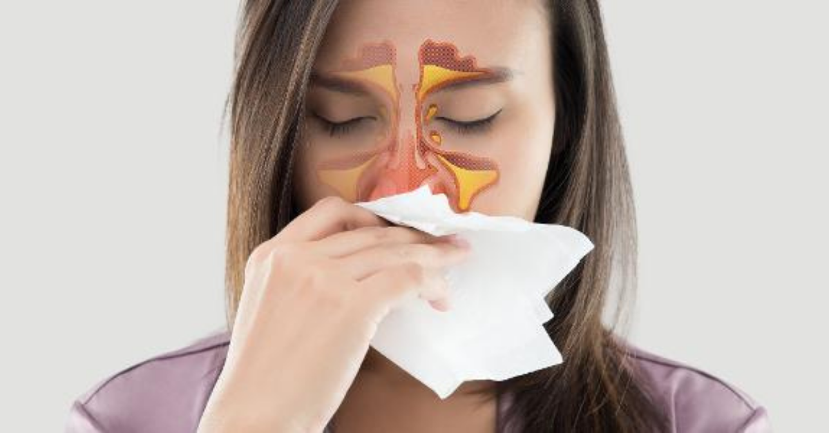 Diferenças entre sinusite e rinite: sintomas e tratamentos
