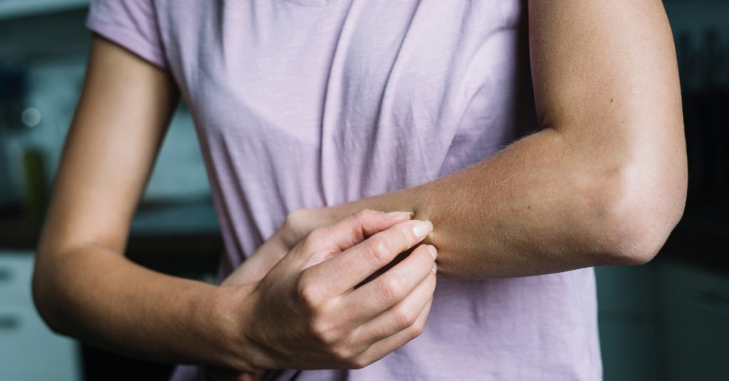 O que é, sintomas e tratamento da impingem