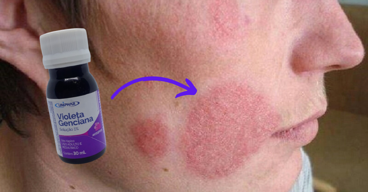 Violeta genciana: saiba para que serve e como usar do jeito certo